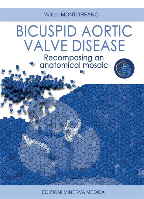 Bicuspid Aortic Valve Disease Recomposing An Anatomical Mosaic M