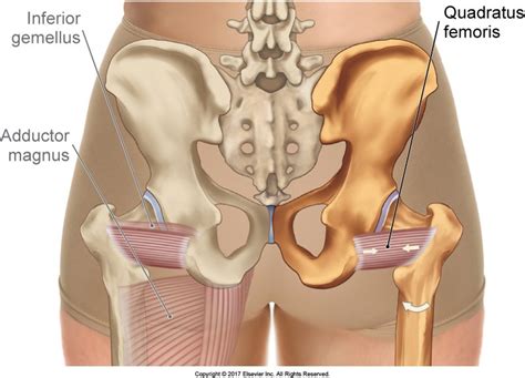 Quadratus Femoris Trigger Point Frontiers Advancing Musculoskeletal