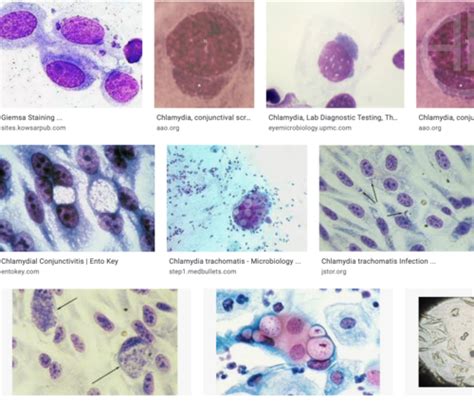 Chlamydia Trachomatis Giemsa Stain