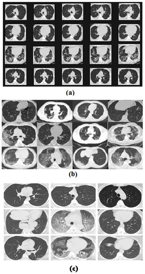 Prediction Of COVID From Chest CT Images Using An Ensemble Of Deep Learning Models