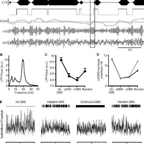 Experimental Setup For Adaptive Deep Brain Stimulation In Externalized
