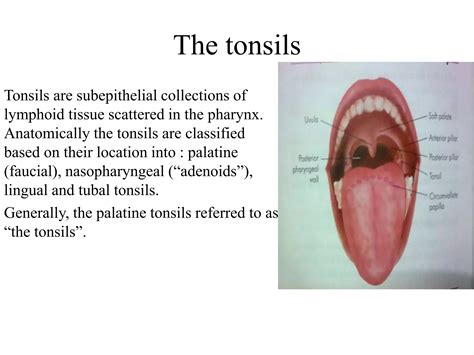 Tonsillitis Pptx