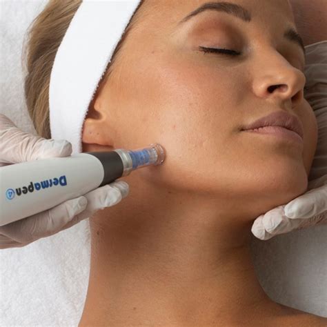 Dermapen 4 Skin Needling Perth Book Your Appointment