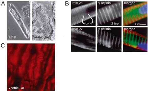 A Isolation Of Atrial And Ventricular Cardiomyocytes From Fresh Human Download Scientific