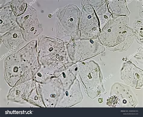 Epithelial Cells Under Microscope
