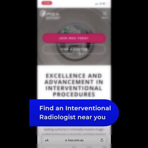 Consensus Guidelines On Anticoagulants In Ir Irsa