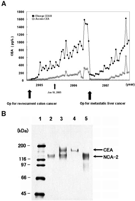 A Serum Cea Concentrations Measured By Different Cea Assays In Colon Download Scientific