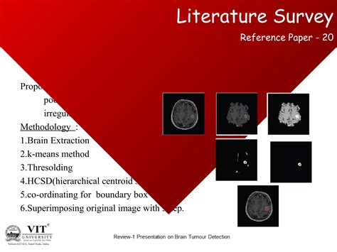 Brain Tumor Detection By Scanning Mri Images Using Filtering Techniques Ppt