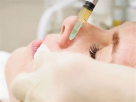 PRP Injection Epitome Med Spa