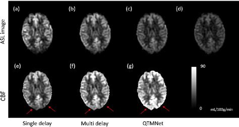 multi delay arterial spin labeled perfusion estimation with biophysics