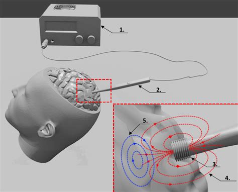 Setup Model Pulse Generator Stimulator Device Coil Magnetic Download Scientific