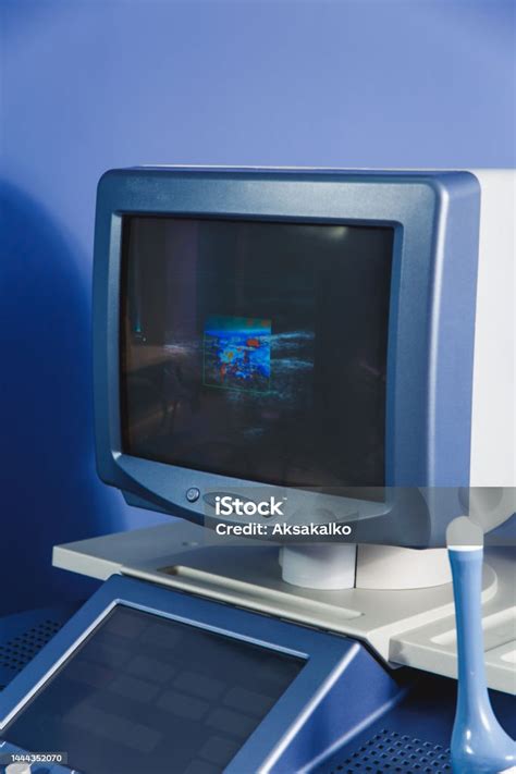 의료 초음파 진단 기계의 디스플레이에 인간의 내부 장기의 이미지 0명에 대한 스톡 사진 및 기타 이미지 0명 X 레이 감시 Istock