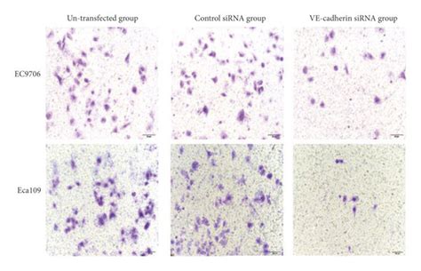 Ad Migration And Invasion Abilities Of Ec Cells After Ve Cadherin