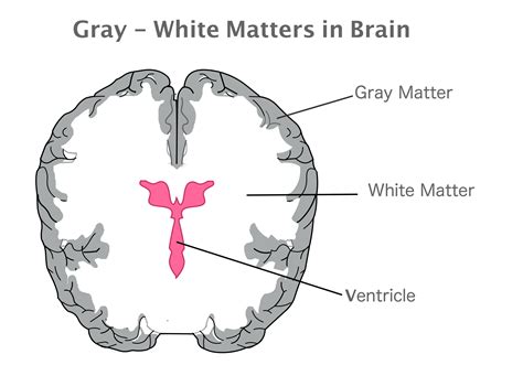 White Matter Development And Language In Autism Autism Research Institute