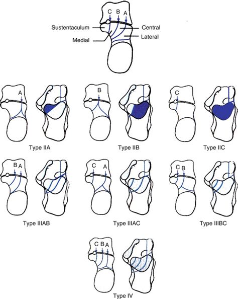 Foot And Ankle Injuries Musculoskeletal Key