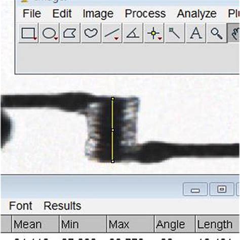 Schematic Diagram Of Axial Measurement Length Download Scientific Diagram