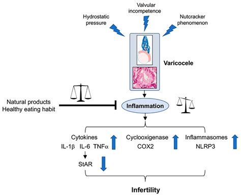 Varicocele Natural Treatment Are You Wearing The Right Underwear A