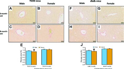 Image Analysis For Quantification Of Fibrosis A J The Frequency Of