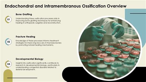 Endochondral Intramembranous Ossification Ppt Example Acp Ppt Presentation