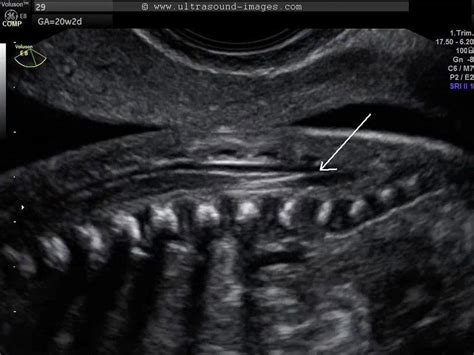 A Gallery Of High Resolution Ultrasound Color Doppler And 3d Images