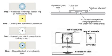 hanging drop method motility test principle and procedure result