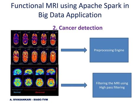 Functional Mri Using Apache Spark In Big Data Application Ppt