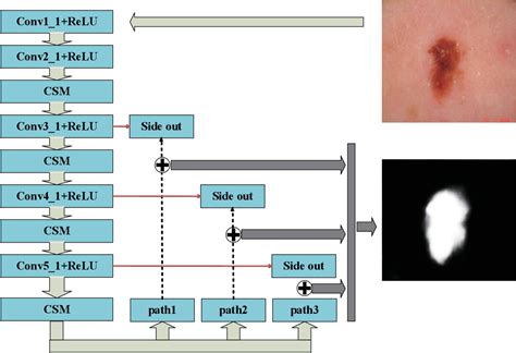 Figure 1 From Deep Attention Guided Fusion Network For Lesion