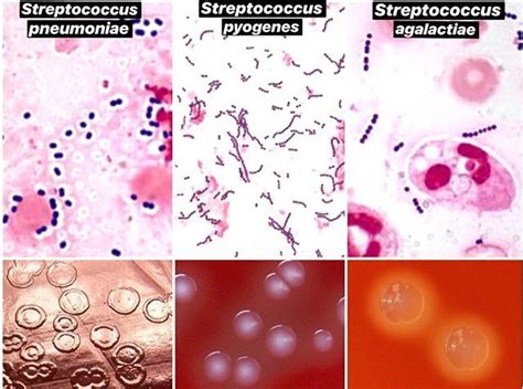 Streptococcus Pyogenes Microscopic