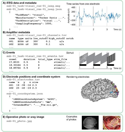 Pictures With Data Types Extending The Bids Specification To Ieeg Download Scientific Diagram