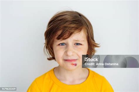 얼굴에 상처 입은 상처로 울고있는 학교 소년 아이의 초상화 노란색 티셔츠를 입은 백인 여학생이 흰색 배경에 얼굴을 다치게 하고 텍스트용 복사 공간을 확보하면서 고통의 울음을