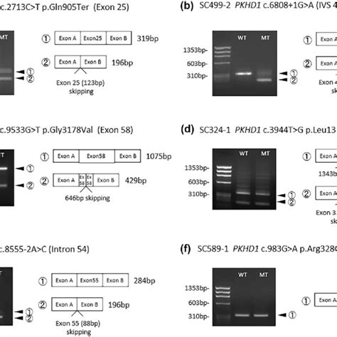 Reverse Transcription Polymerase Chain Reaction Amplified Products Of Download Scientific