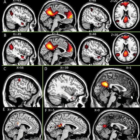Brain Activation Self Reflection Task Main Effects For A Self Download Scientific Diagram