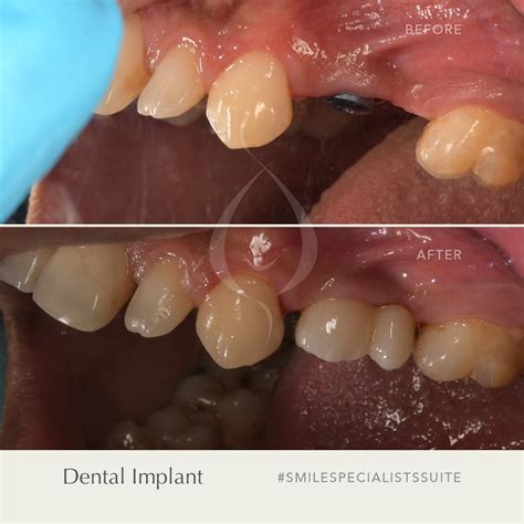 Dental Implant Smile Specialists Suite