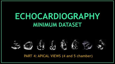 Echocardiogram Minimum Dataset Part 4 Apical 4 And 5 Chamber Views