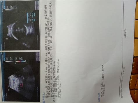 一颗心终于落地的图片 终于安心了图片 悬着的心落了片 大山谷图库