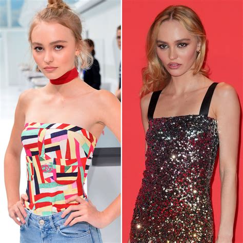Lily Rose Depp Plastic Surgery Transformation Photos Life And Style