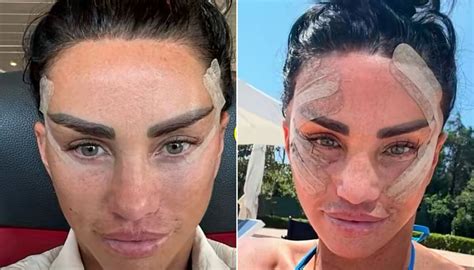 Katie Price Unveils Bandaged Face As She Recovers From Surgery Celebrity News Showbiz And Tv