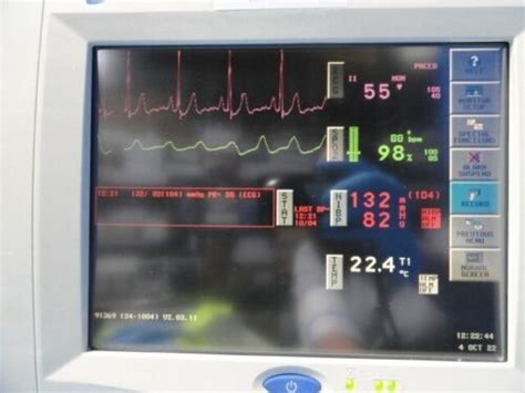 Used Spacelabs 91496 Multiparameter Patient Module For Sale Dotmed Listing 4412846