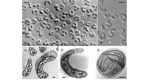 Lm And Tem Micrographs Of Raphidocelis Subcapitata In Culture Scale Download Scientific