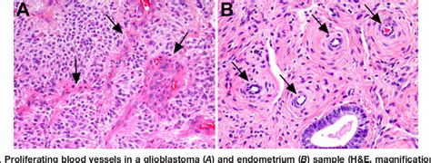 Figure 1 From A Proteome Comparison Between Physiological Angiogenesis