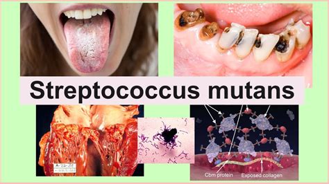 Streptococcus Mutans Youtube