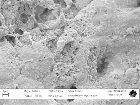 What Are Your Thoughts On These Electron Microscope Images ResearchGate