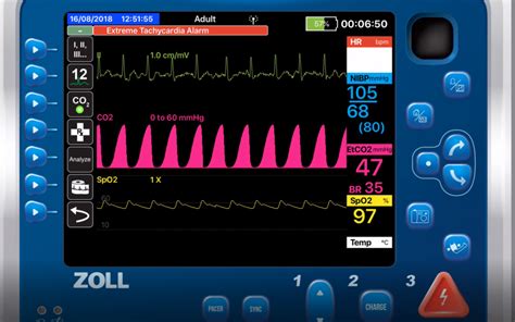 Capnography Archives Ems Airway
