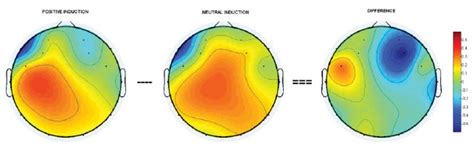 Topographic Scalp Map Of Average Alpha Erd Values Download Scientific Diagram