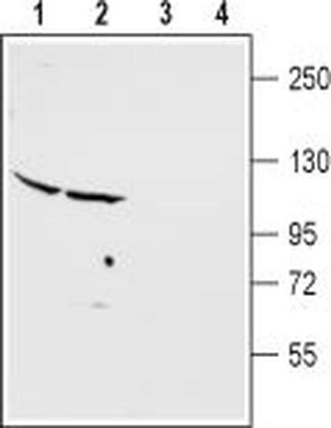 Mglur2 Extracellular Polyclonal Antibody Agc 011 200ul