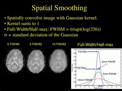 Ppt Basics Of Fmri Preprocessing Powerpoint Presentation Free Download Id 3944532
