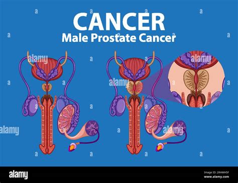 Illustrated Infographic Highlighting Differences Between Healthy And