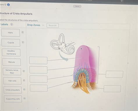 Solved Hent 12tructure Of Crista Ampullarisabel The