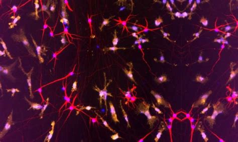 App Note Optimisation For A Live Cell In Vitro Neuronal Activity Assay Drug Discovery World Ddw