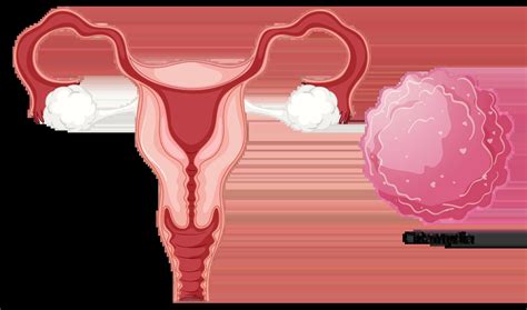 Chlamydia Symptoms Causes Diagnosis And Treatment